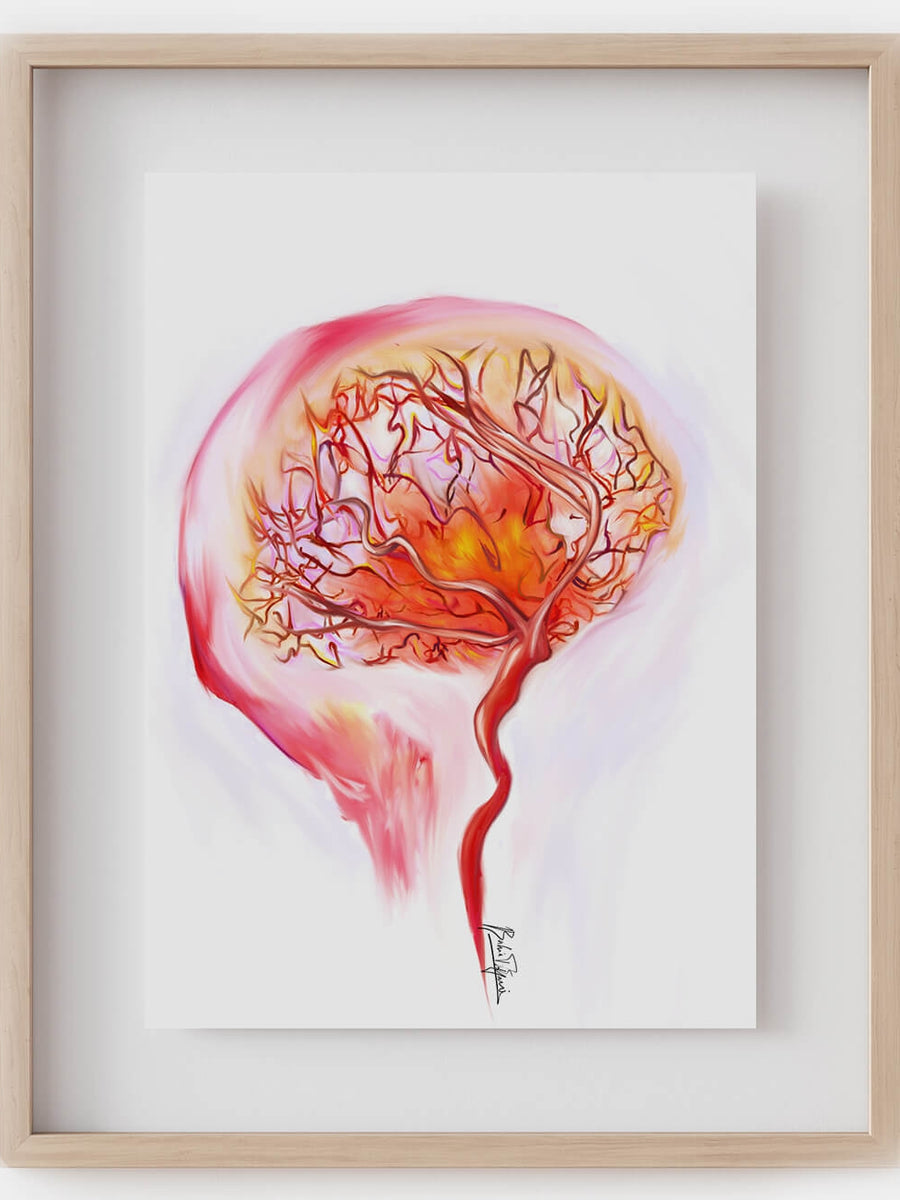Cerebral angiography art print| brain artwork