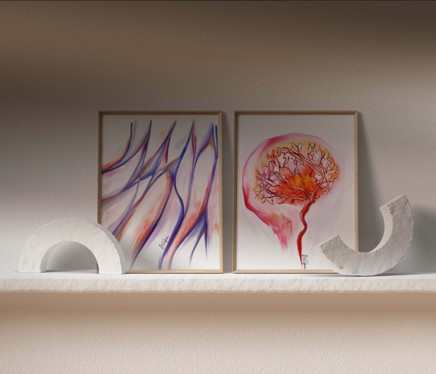Cerebral angiography art print| brain artwork