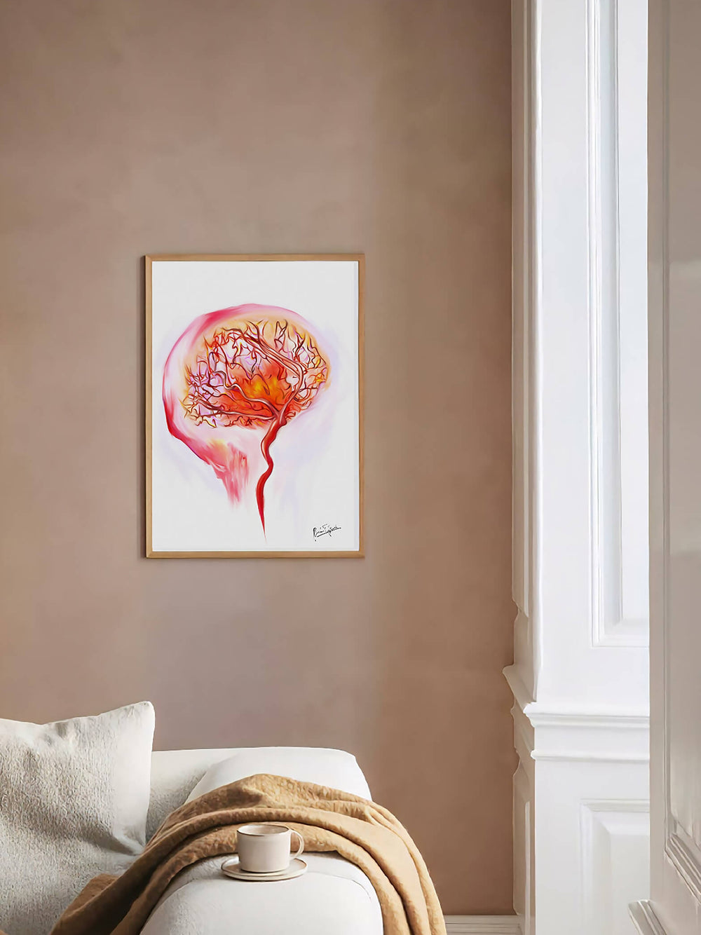 Cerebral angiography art print| brain artwork