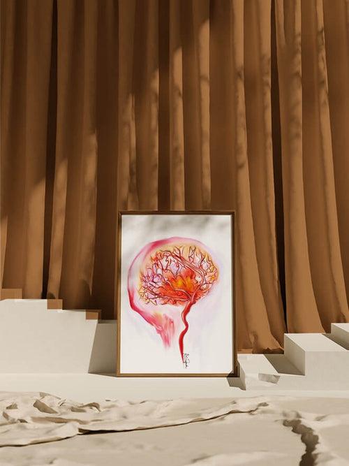 Cerebral angiography art print| brain artwork