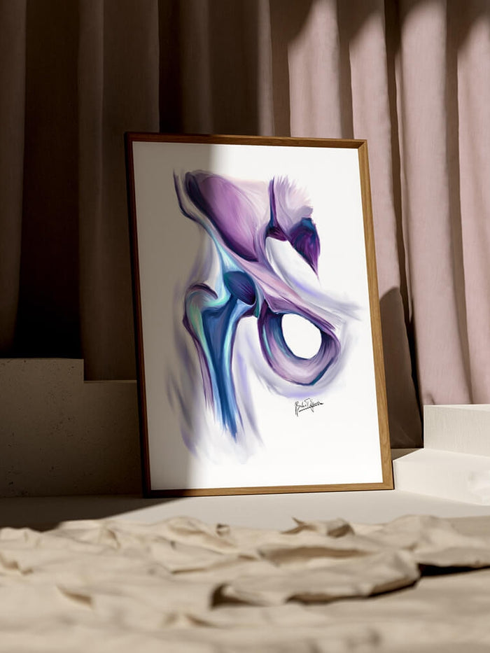 Hip replacement art