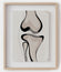 knee joint art-orthopedic art