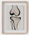 knee joint art-orthopedic art