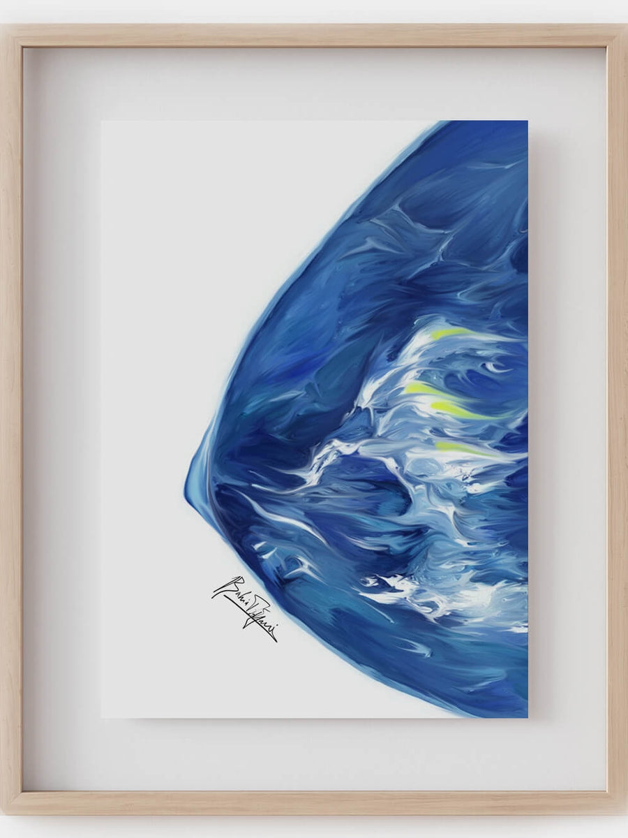 Mammogram art | abstract breast anatomy artwork